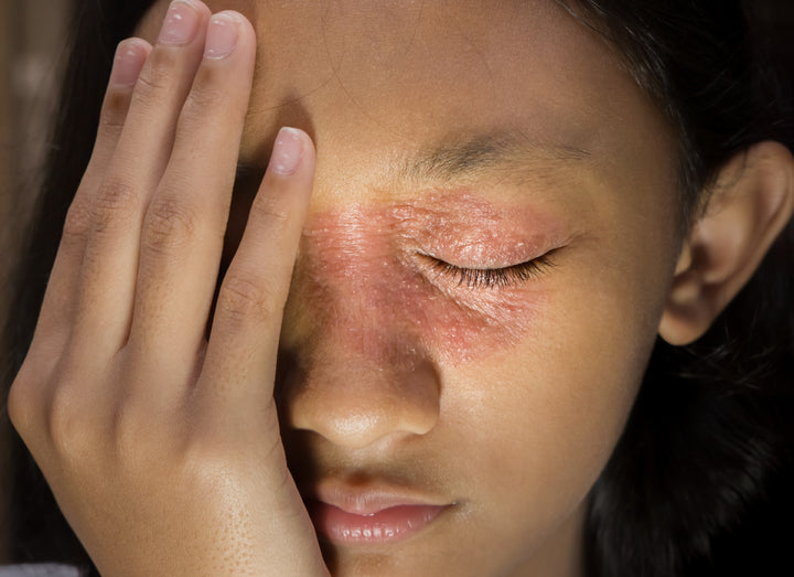 Info Hub – Tagged "periocular dermatitis" – Balmonds