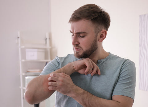 Polymorphic Light Eruption (PMLE) – Balmonds