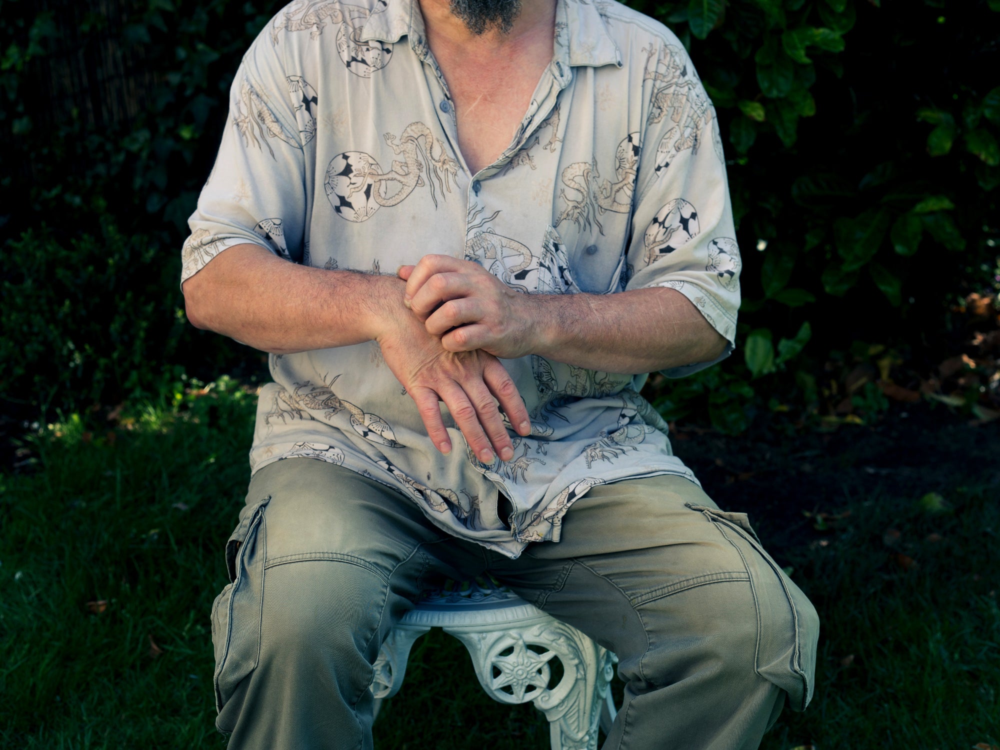 Best Natural Treatments For Diabetic Rash – Balmonds